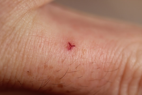 Ground Leech | Project Noah