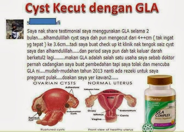 BLOG FAMILI ADLYNA: Ketumbuhan dalam rahim / Cysts
