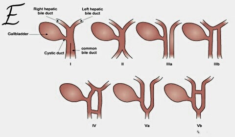 ERCP & EGD : Uncommon biliary tree anatomy