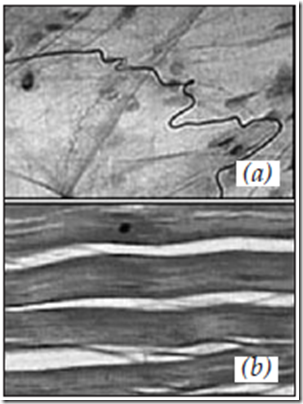 Jaringan Pengikat (Konektif)–ikat longgar dan padat - Pengertian