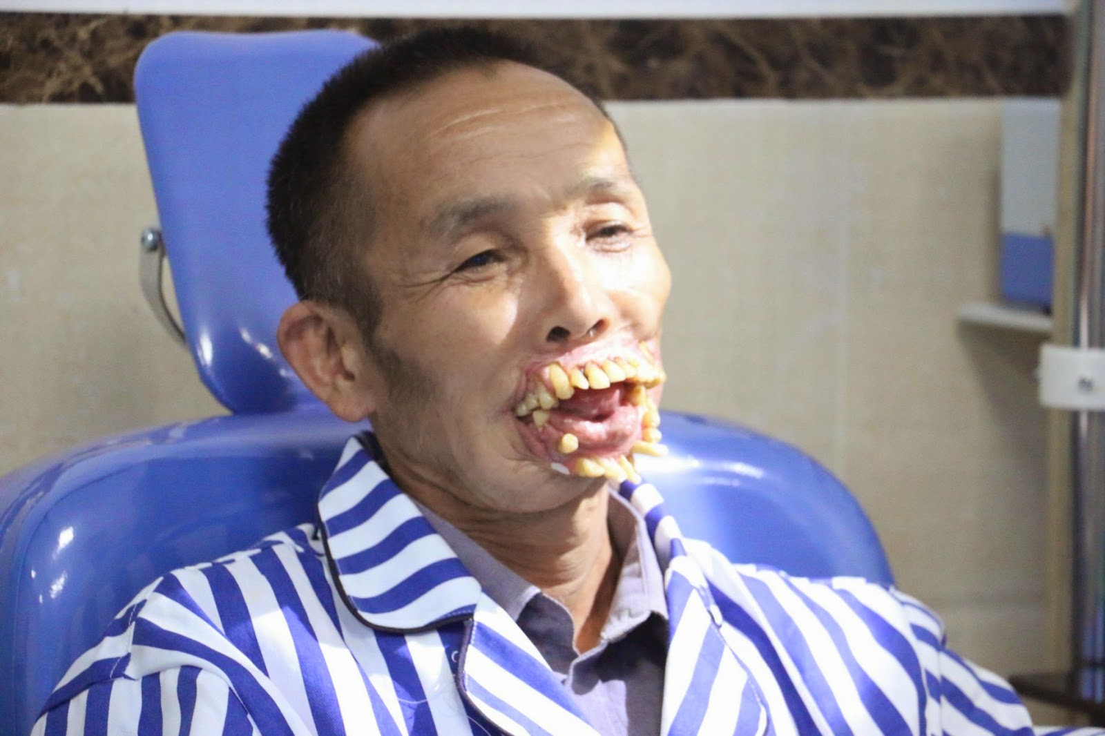 Welcome to Joseph Nwoye blog: PHOTOS: Mouthless Man Attacked By Wolf To ...