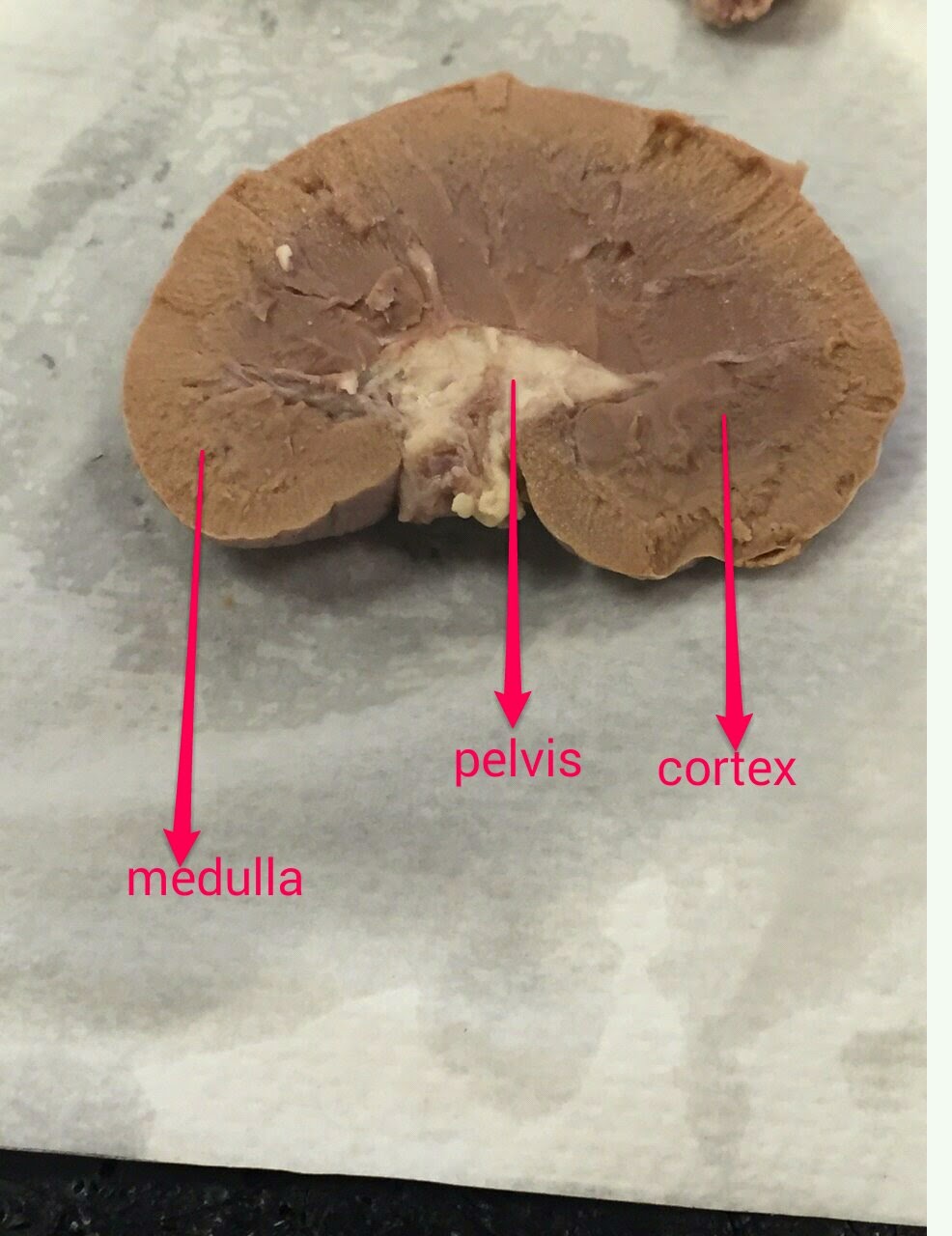 Shimmi's Biology Blogs: Kidney Dissection!