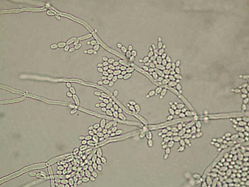 Atlas com os principais fungos de importância médica | Biomedicina Padrão