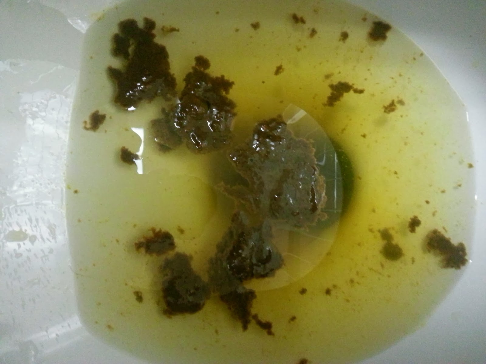 My Daily Poo: 6 Feb: Poo soup anyone?