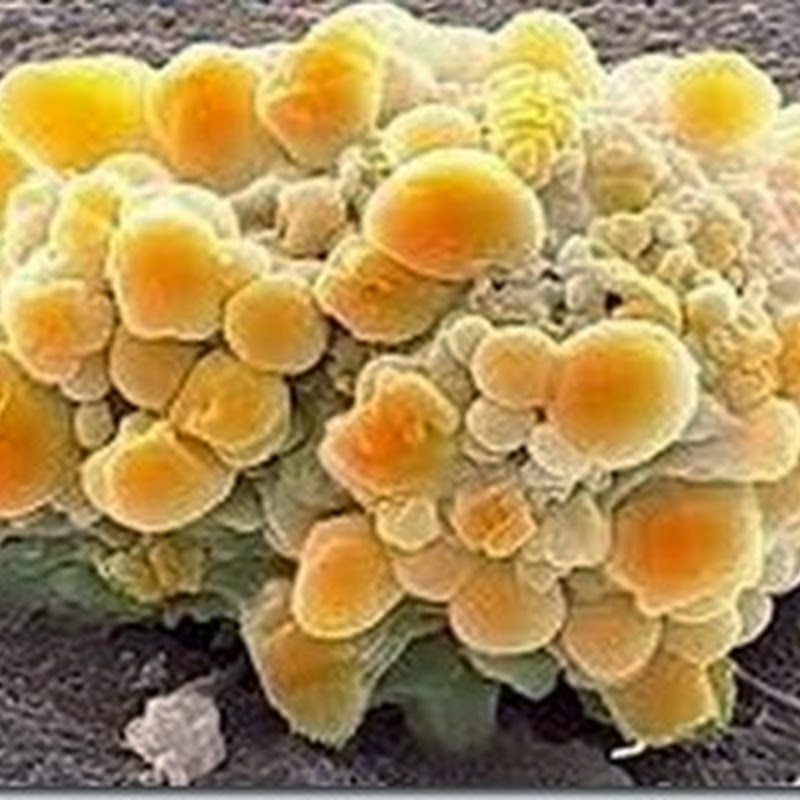 Fastest growing cancer or tumor in human body | MedicoTips.Com