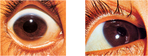 Fatimah Hidayati (Travel Notes of A Lifelong Learner): Pencegahan ...