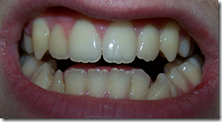 Daniel 'The' Pope: All about my teeth