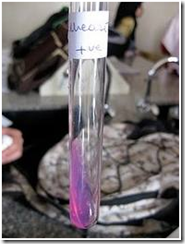 KOLEKSI TUGASAN: MIKROBIOLOGI - UJIAN UREASE & UJIAN ONPG