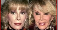 What Joan Rivers Can Teach Us About Cosmetic Surgery | Beauty and ...