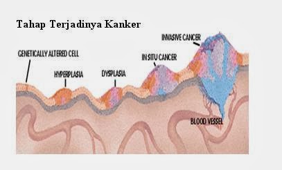 ILMU KESEHATAN: KANGKER