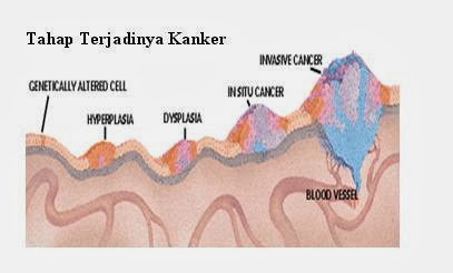 ILMU KESEHATAN: KANGKER
