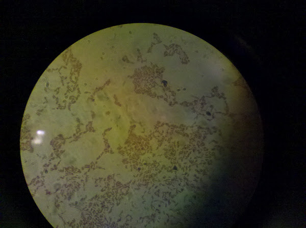 Fluorescent Pseudomonads | Project Noah