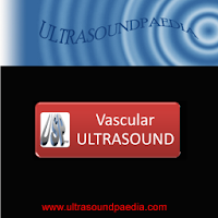 「Vascular Ultrasound」 - Androidアプリ | APPLION