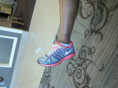 Calcaneal Osteotomy and Strayer Surgery: April 2011