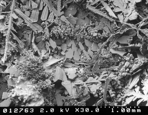 Snow under the electron microscope | Amusing Planet
