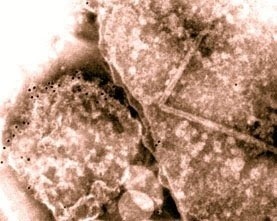 Golden Bacteria or Bacterial Gold | The ItsyBitsy bLoG