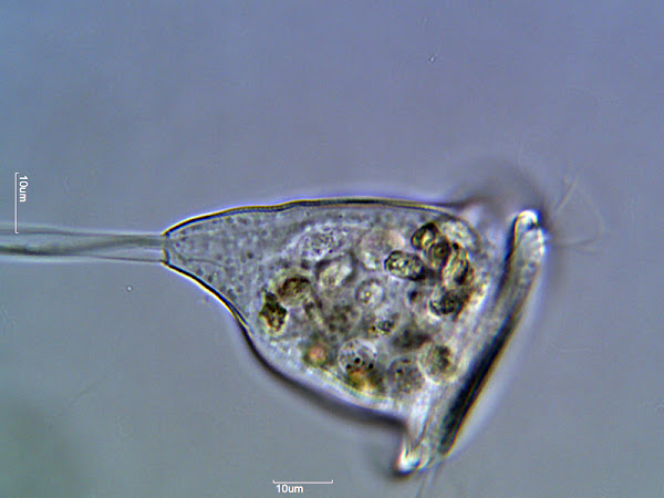 Vorticella | Project Noah