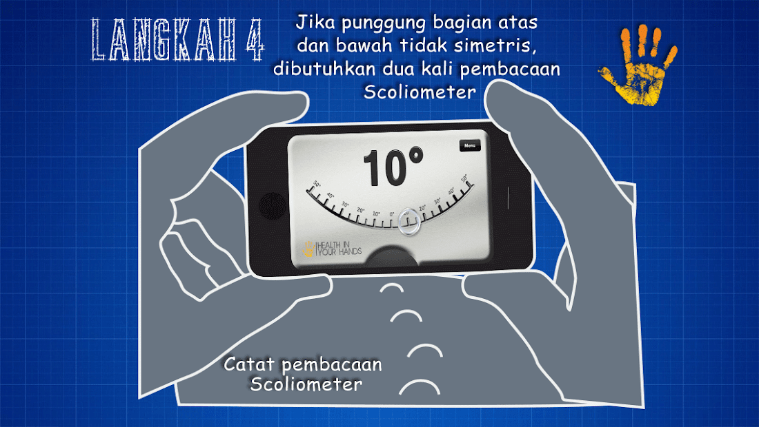 Skoliometer - Aplikasi di Google Play