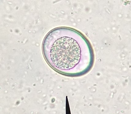 Coccidia Oocyst | Project Noah